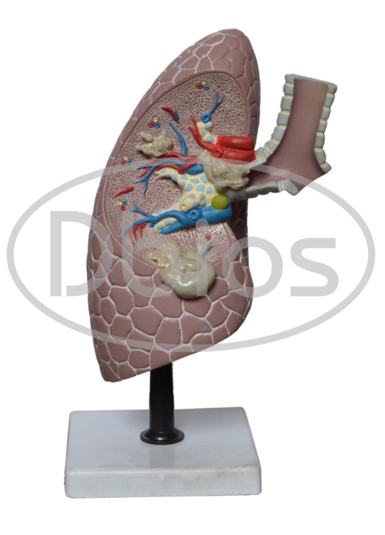 Pathology Models-Slides – For Classes, Not Masses